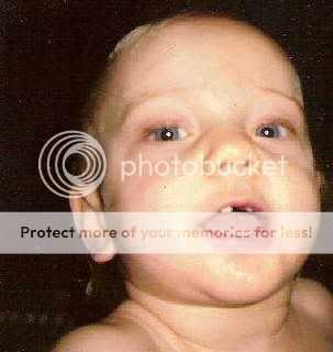 Blake Rupee, 14-month-old, dies from abuse; ruled homicide. | The Demon ...